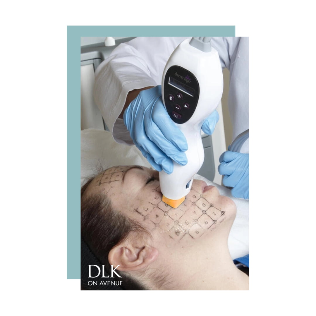 What is Thermage: DLK’s Guide to Skin Tightening